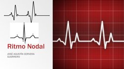 Características del Ritmo Nodal en ECG | PDF | Enfermedades ...
