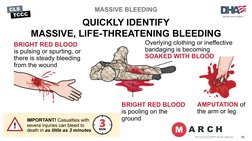 TCCC Tactical Trauma Assessment Guide | PDF | Clinical Medicine ...