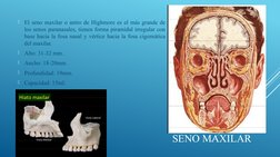 Técnica Quirúrgica Caldwell-Luc | PDF | Cabeza y cuello humanos ...