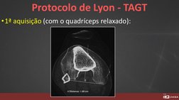 Protocolo de Lyon para Tomografia de Joelho | PDF