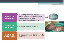 Signos radiográficos de óbito fetal | PDF