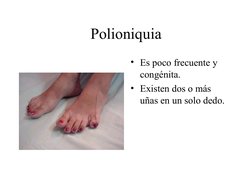 Alteraciones de las Uñas y Onicopatías | PDF | Clavo (anatomía) | Pie