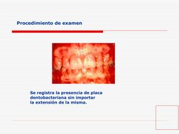 Índice de Placa de O'Leary: Procedimiento y Cálculo | PDF | Odontología ...