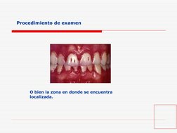 Índice de Placa de O'Leary: Procedimiento y Cálculo | PDF | Odontología ...