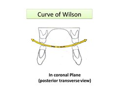 Curves of Occlusion in Prosthodontics | PDF | Mouth | Dentistry Branches