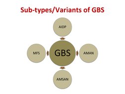 Overview of Guillain-Barré Syndrome | PDF | Myelin | Clinical Medicine