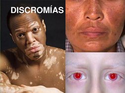 Tipos y causas de discromías cutáneas | PDF | Piel | Enfermedades y ...