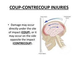 Head Injury: Types and Management | PDF | Traumatic Brain Injury | Injury