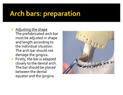 Arch Bar Applications in Oral Surgery | PDF | Tooth | Mouth