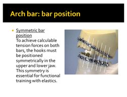 Arch Bar Applications in Oral Surgery | PDF | Tooth | Mouth