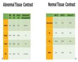 Essential MRI Parameter Charts | PDF | Magnetic Resonance Imaging | Aorta