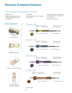 Stryker Fixos Screws Operative Guide | PDF | Screw | Implant (Medicine)