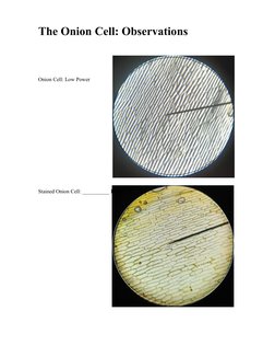 Onion Cell Experiment Lab Report | PDF | Cell (Biology) | Staining