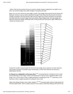 KVP and MAS in Radiographic Technique | PDF | Radiography | X Ray