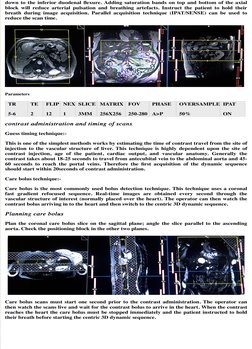 MRI Protocol for Pancreas Imaging | PDF | Magnetic Resonance Imaging ...