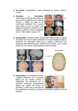 Clasificación del Índice Cefálico | PDF | Salud infantil | Sistema ...