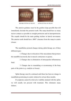 Roth Bracket Prescription Overview | PDF | Science & Mathematics