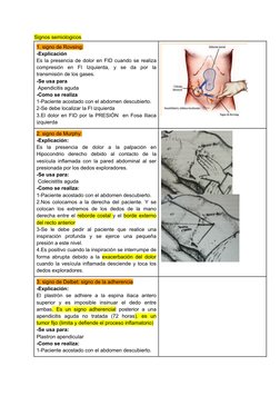 Signos Semiológicos en Apendicitis y Fecaloma | PDF | Abdomen ...
