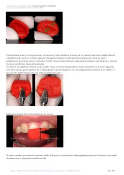 Confección del Jig de Lucia en Odontología | PDF | Ramas de Odontología