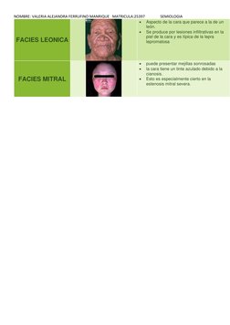 Tipos de Facies en Semiología Médica | PDF | Anatomía | Anatomía humana