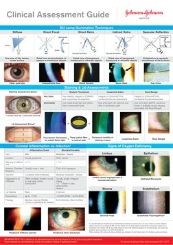 Efron Grading Scale for Eye Assessments | PDF | Cornea | Contact Lens