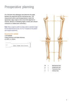 TKR Smith&nephew Technique Orthomatch GENESIS II Surgical Technique.10. ...